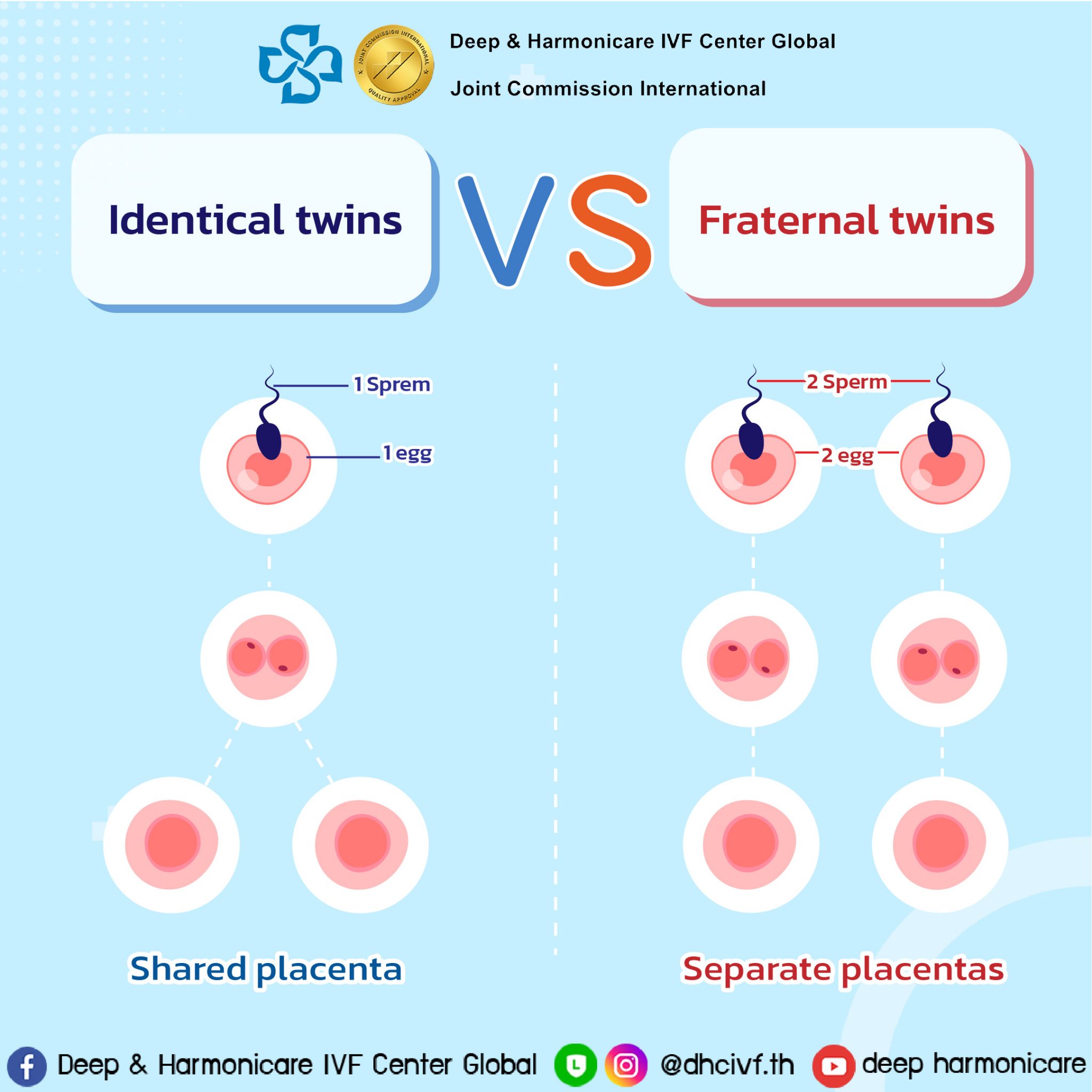 Essential information about twins pregnancy, type of twin | DHC
