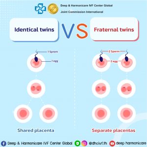 Essential information about twins pregnancy, type of twin | DHC